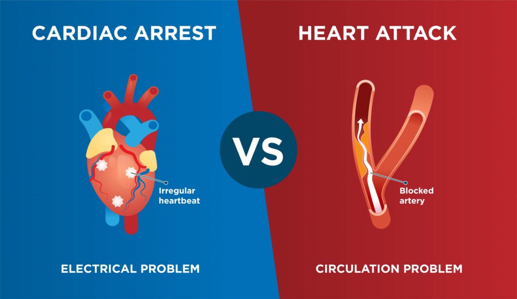 Heart Attack vs Cardiac Arrest - Southern Dallas Magazine